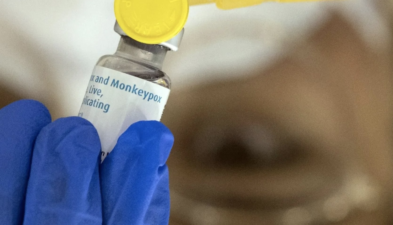 OMS declara virus del mono como emergencia internacional de salud ...